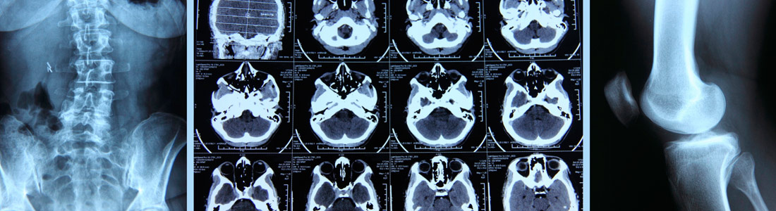 Rayos X Del Cuerpo Humano